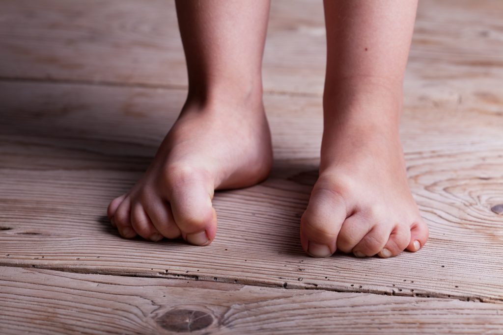 Symptoms Of Foot Gout | RNV Podiatry